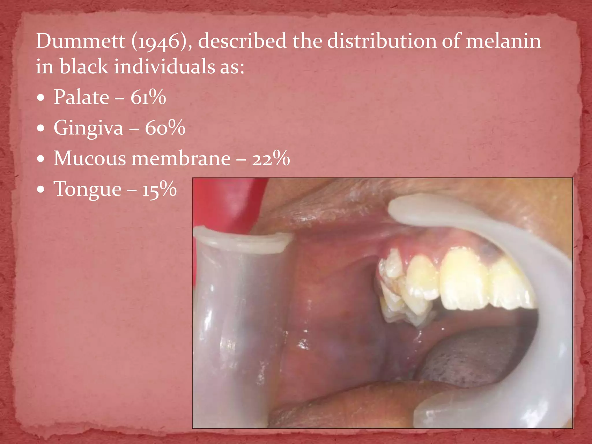 Clinical examination of gingiva | PPTX