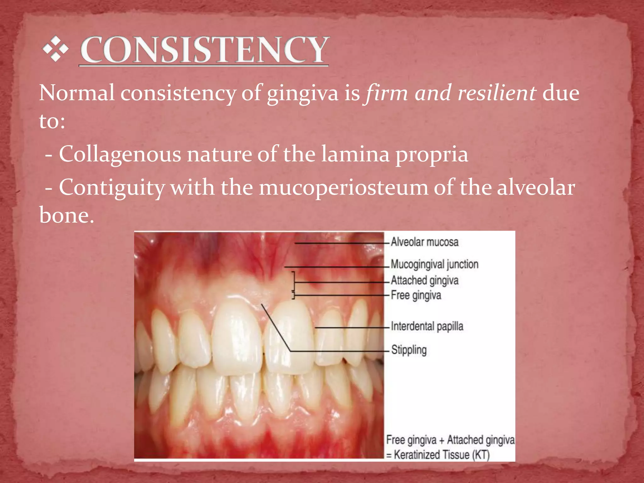 Clinical examination of gingiva | PPTX