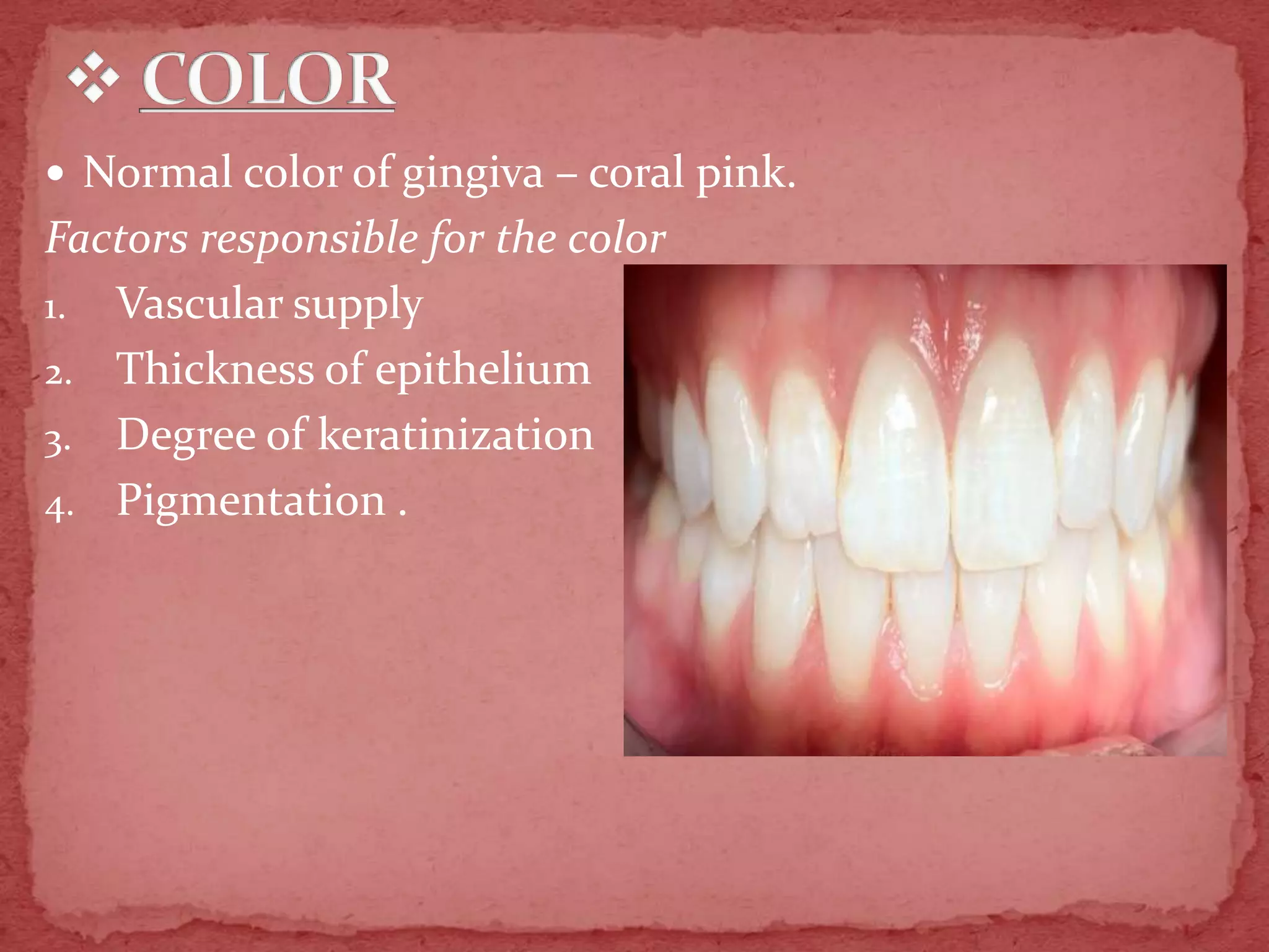 Clinical examination of gingiva | PPTX