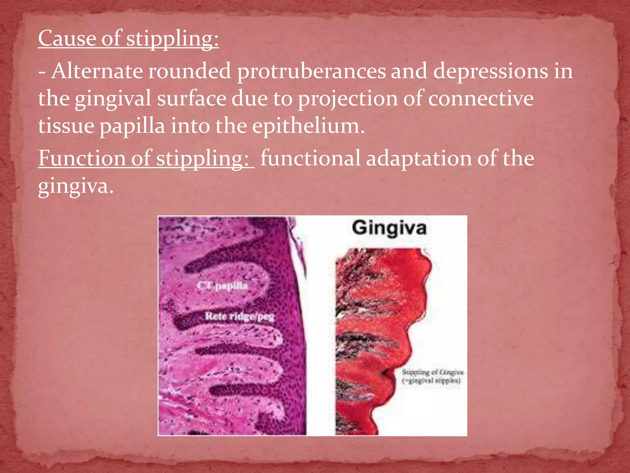 Clinical examination of gingiva | PPTX