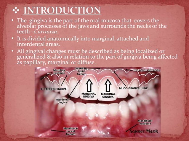 Clinical examination of gingiva | PPTX | Oral care | Personal Care