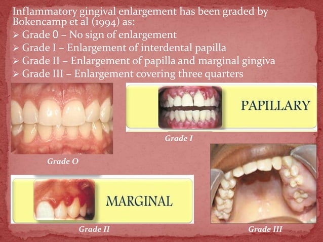 Clinical examination of gingiva | PPTX | Oral care | Personal Care