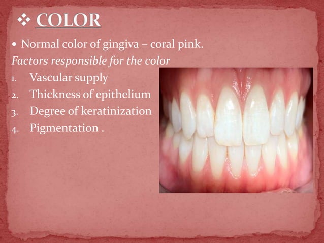 Clinical examination of gingiva | PPTX | Oral care | Personal Care