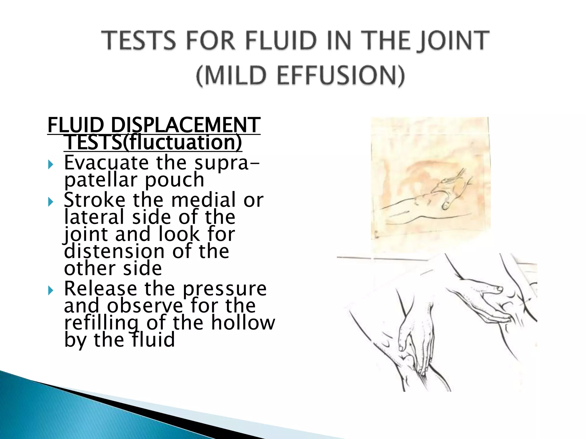 CLINICAL EXAMINATION OF KNEE.pptx