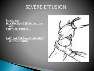 CLINICAL EXAMINATION OF KNEE.pptx