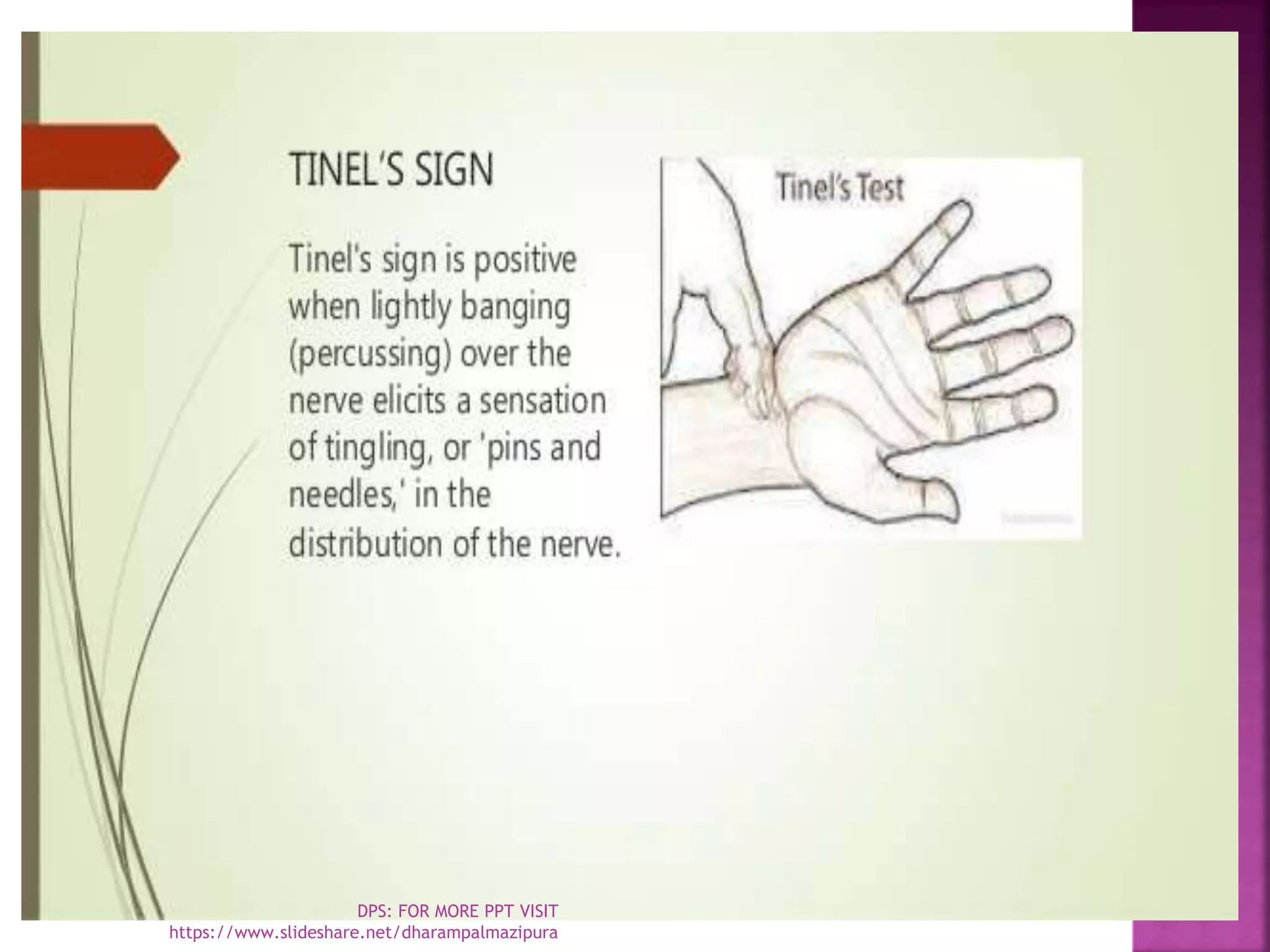Clinical examination of median nerve by DR. D. P. SWAMI | PPTX