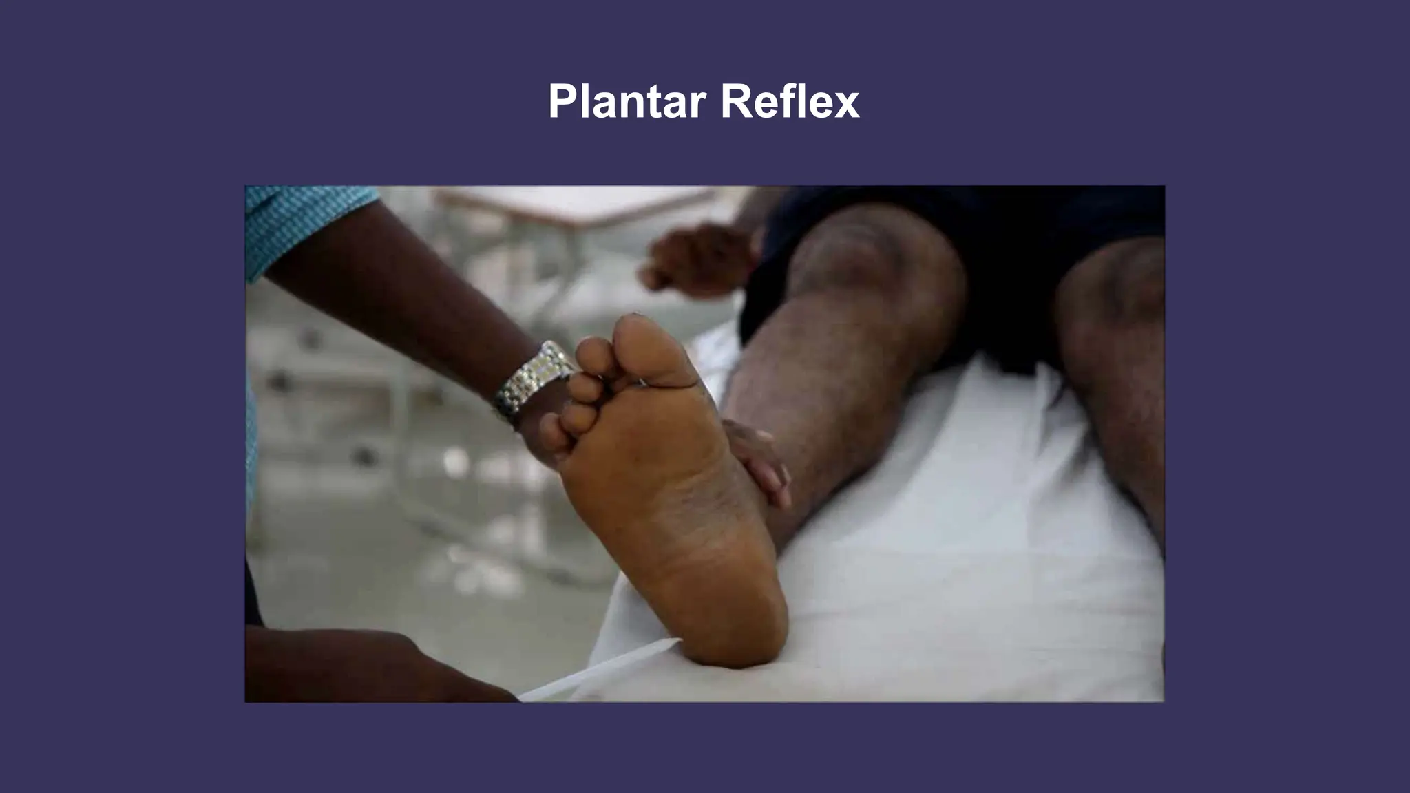 Clinical Examination of Plantar Reflex.pptx