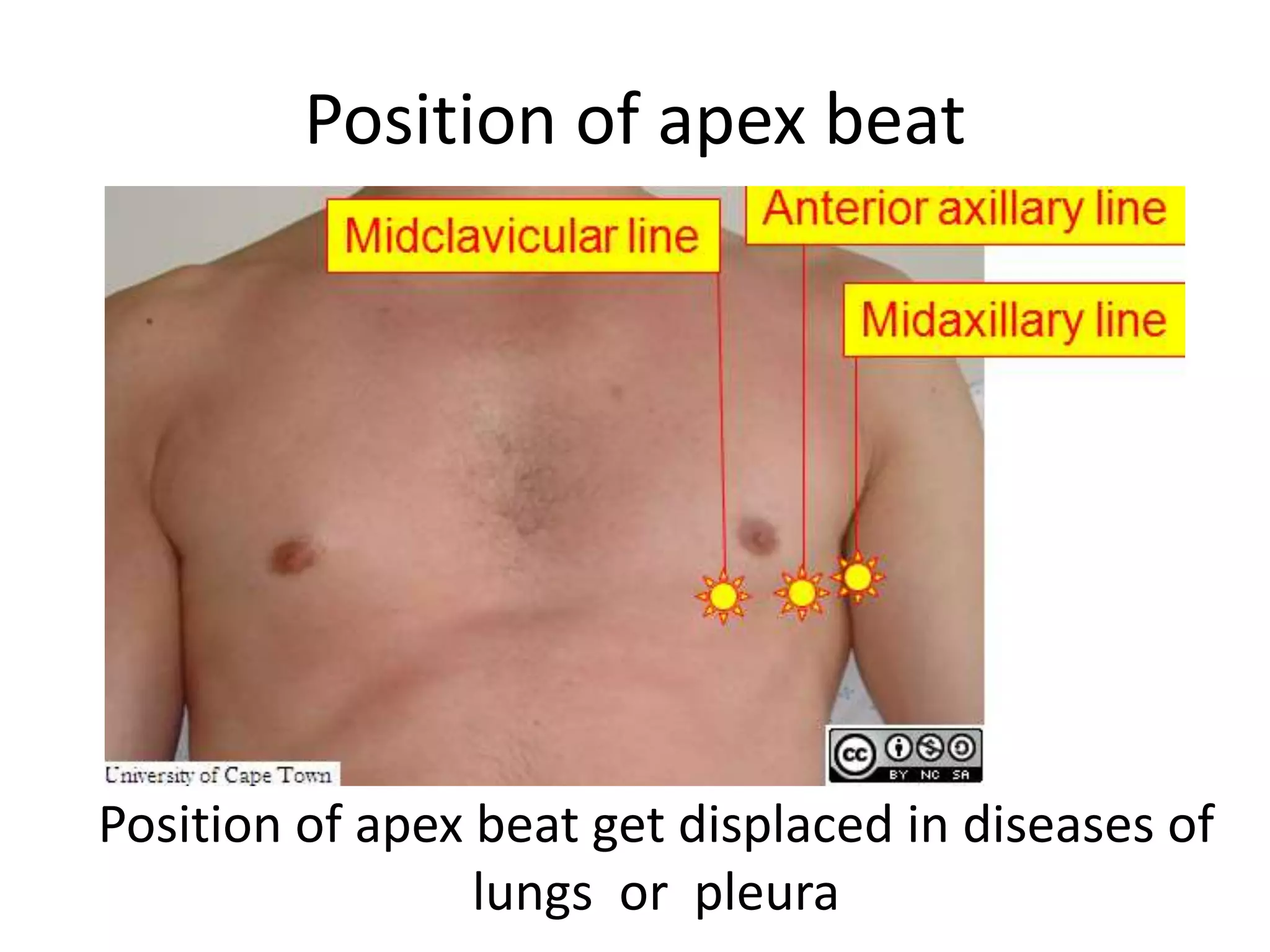 Clinical examination of Respiratory System by Pandian M, tutor, Dept of ...