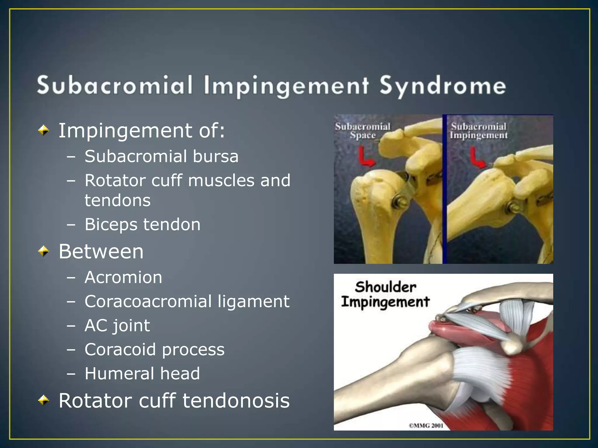 clinicalexaminationofshoulder.pptx