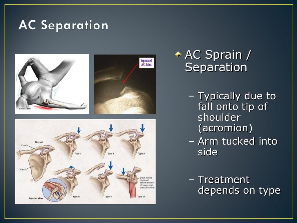 Clinical Examination Of Shoulder