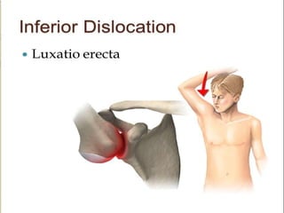 CLINICAL EXAMINATION OF SHOULDER DISLOCATION.pptx