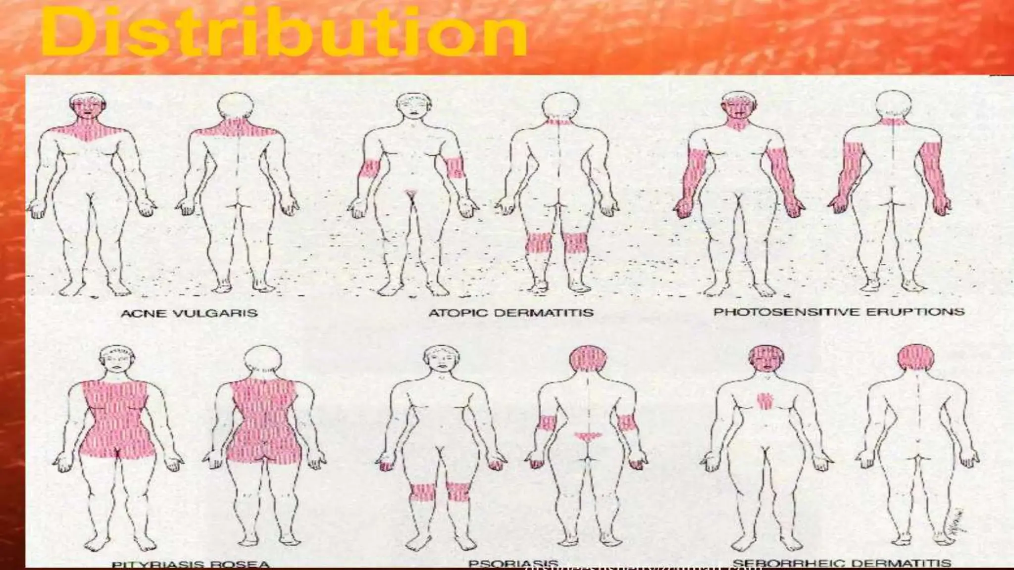 Clinical Examination of Skin and its disorders | PPT