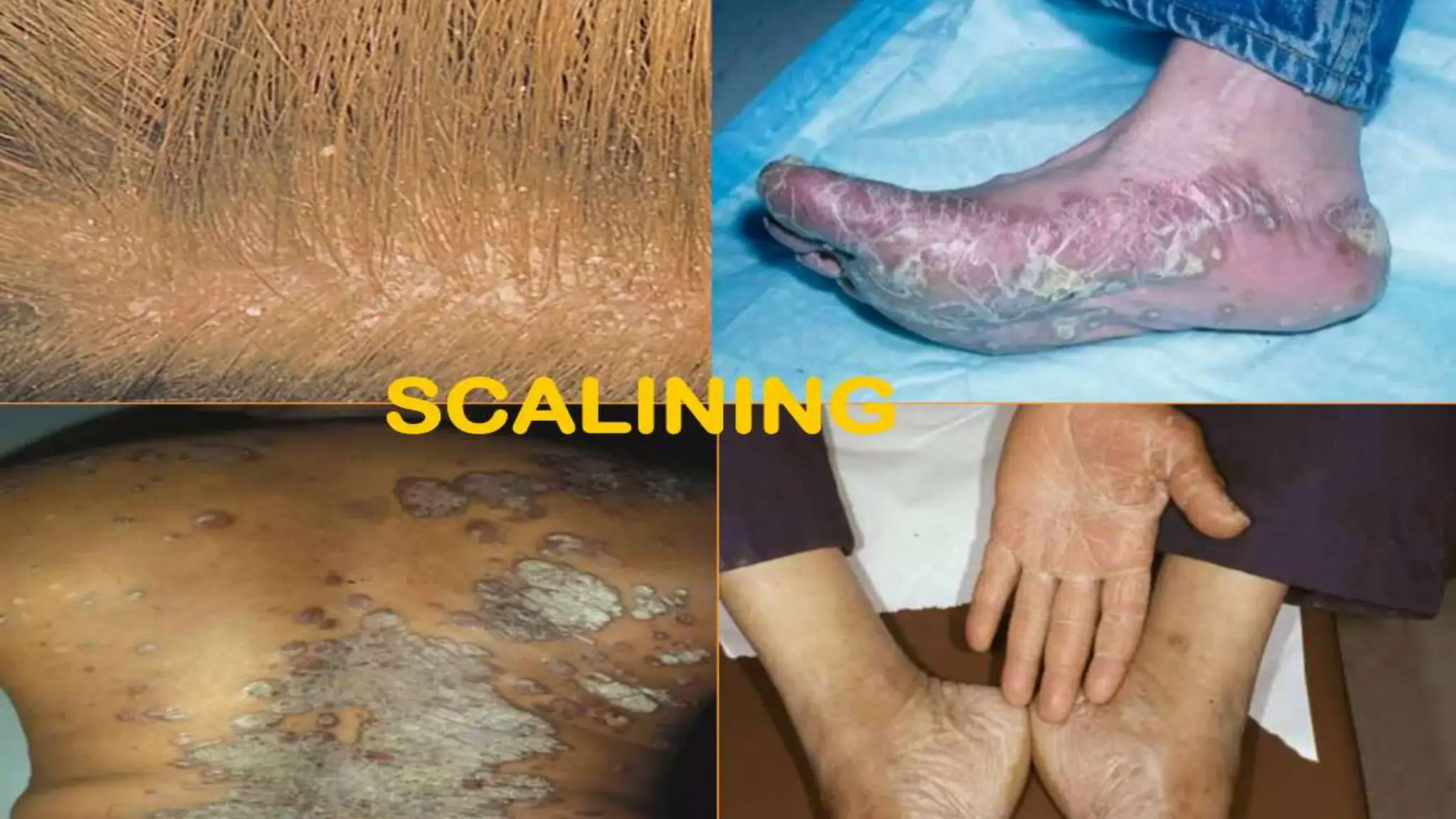 Clinical Examination of Skin and its disorders | PPT