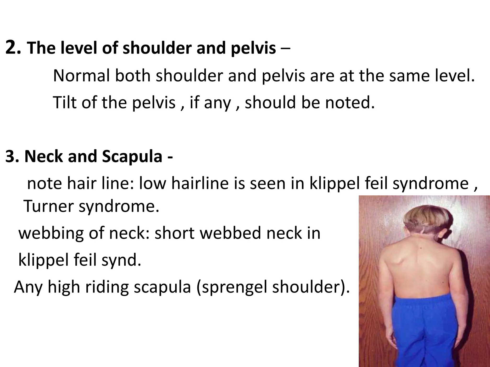 Clinical examination of spine | PPT