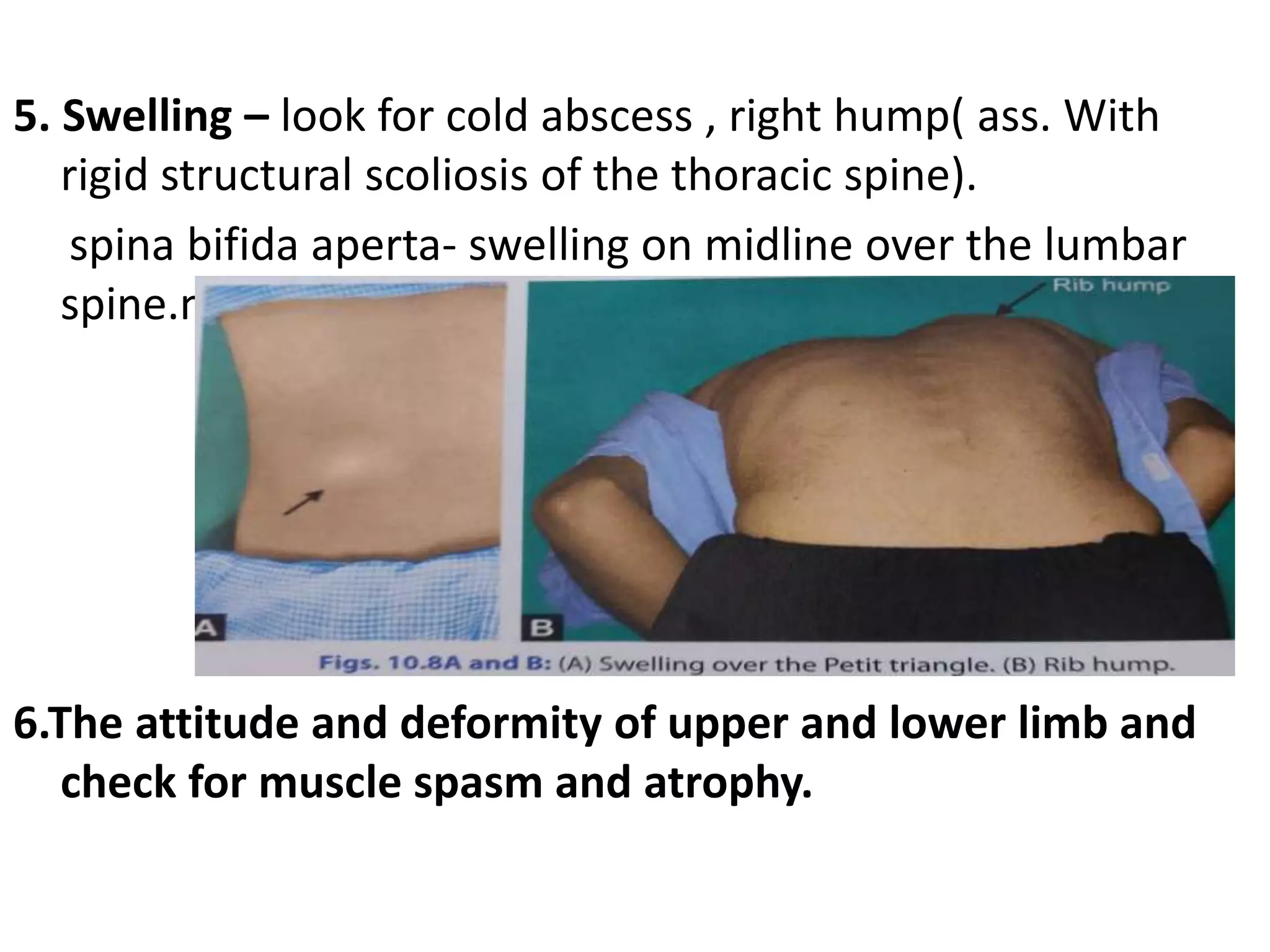 Clinical examination of spine | PPT