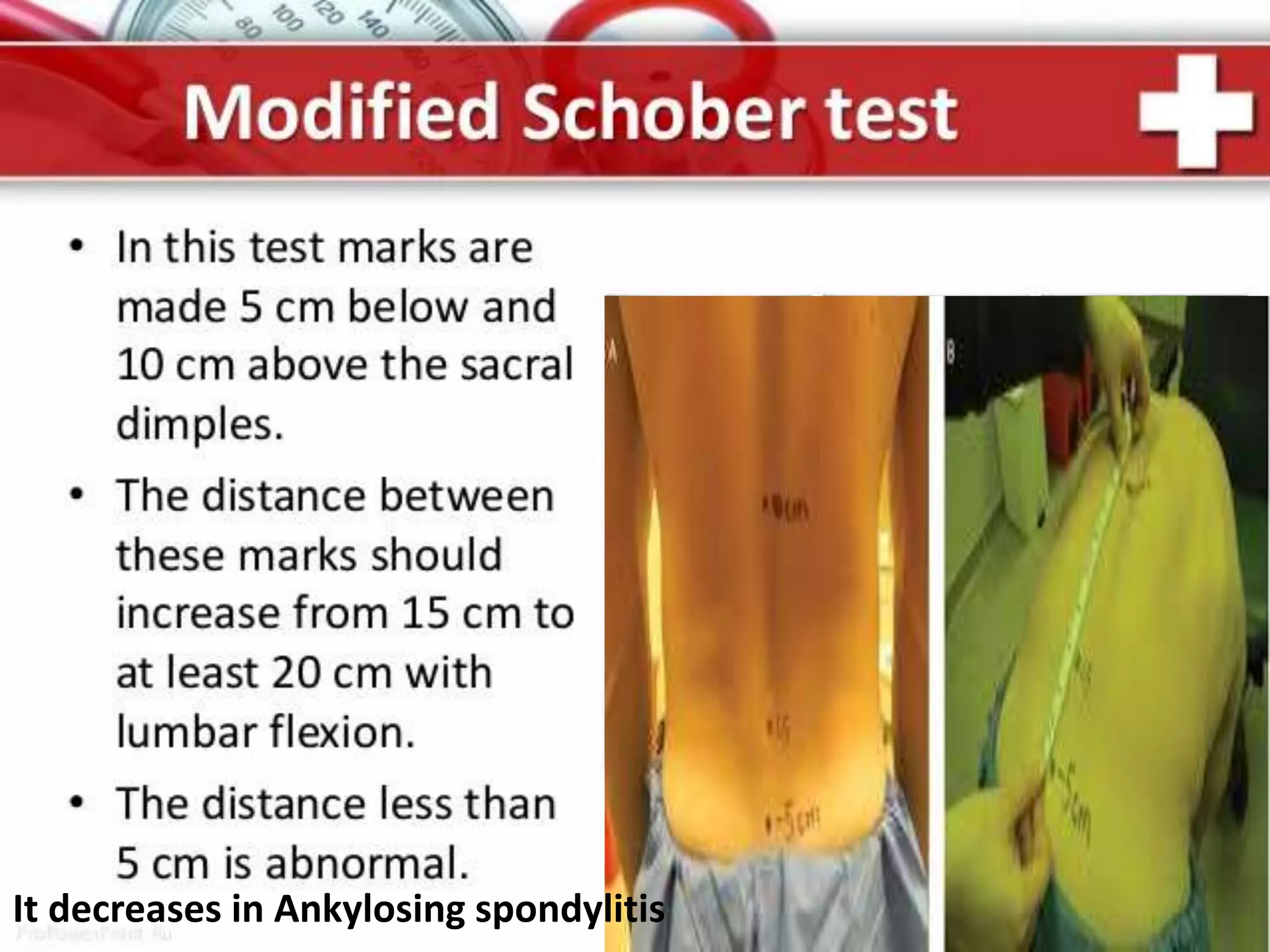Clinical examination of spine | PPT