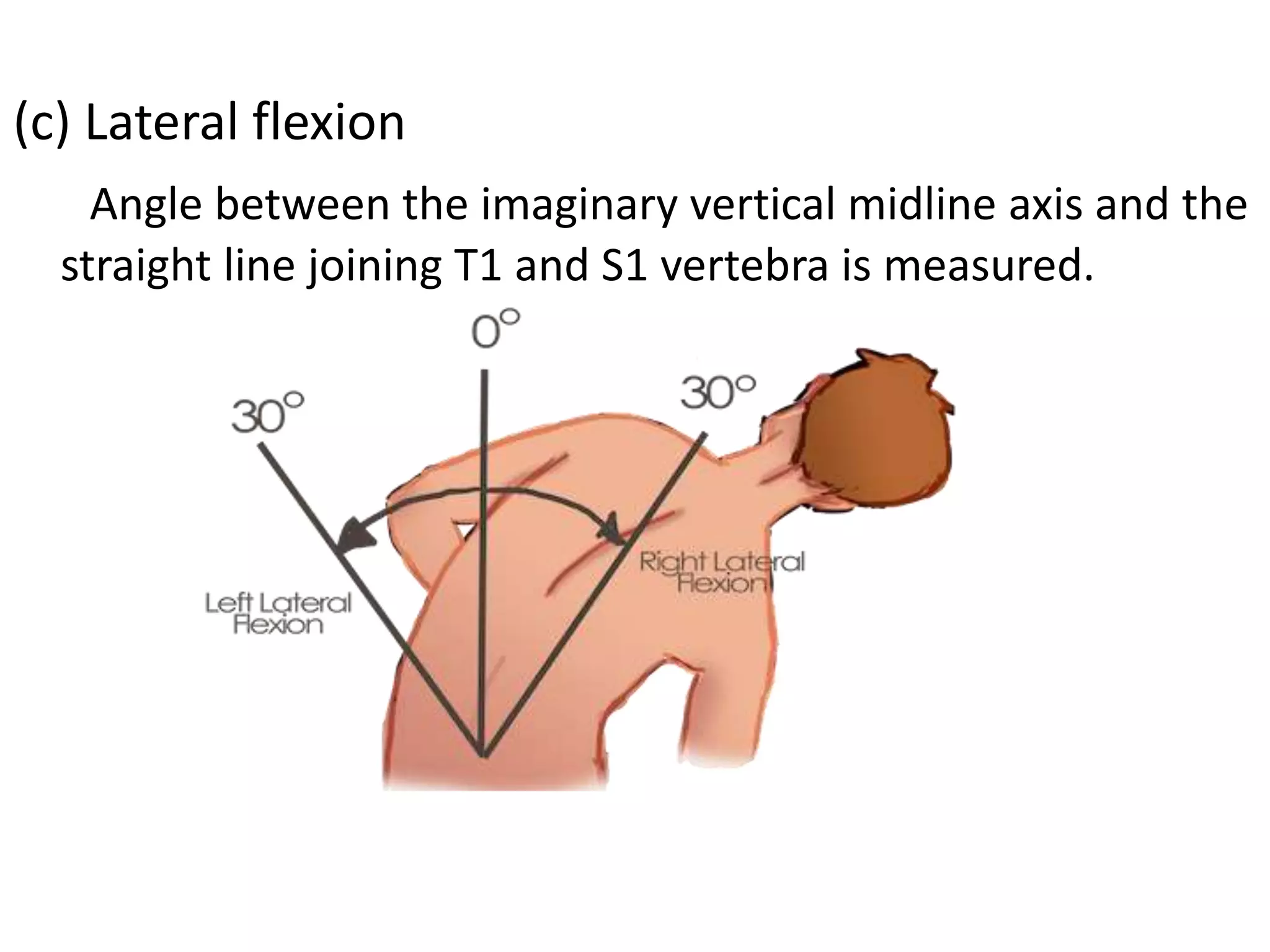 Clinical examination of spine | PPT