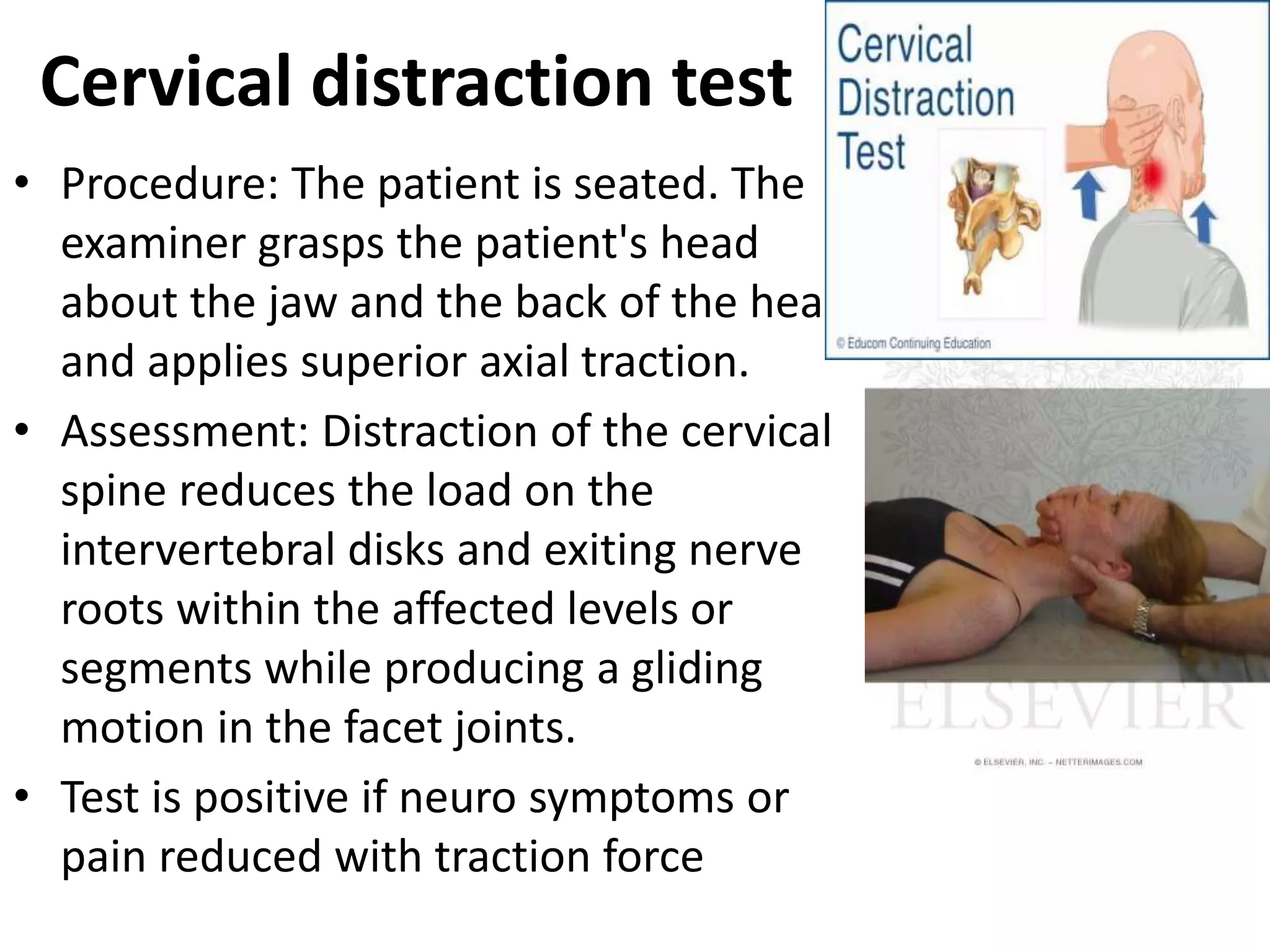 Clinical examination of spine | PPT