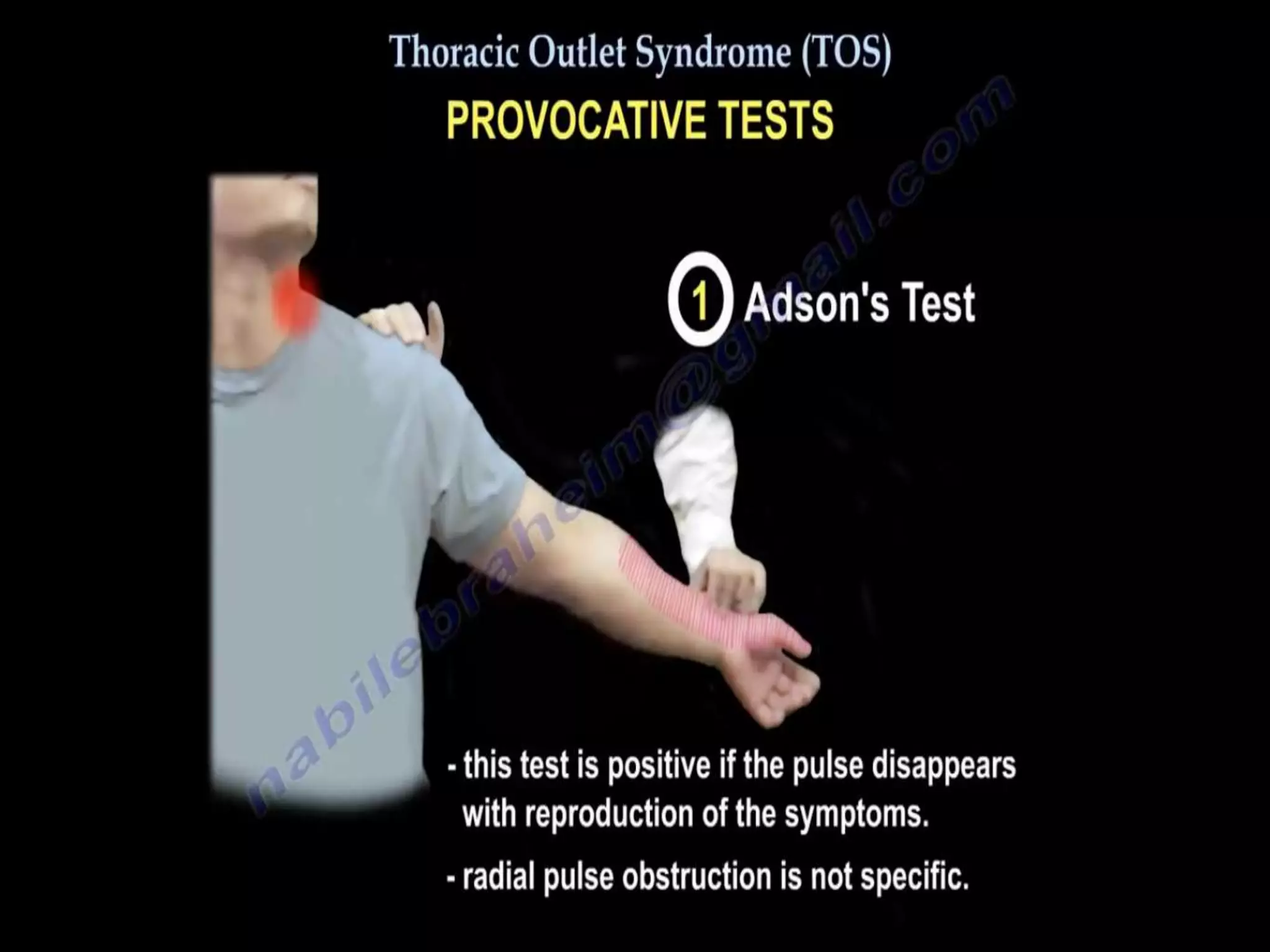 Clinical examination of spine | PPT
