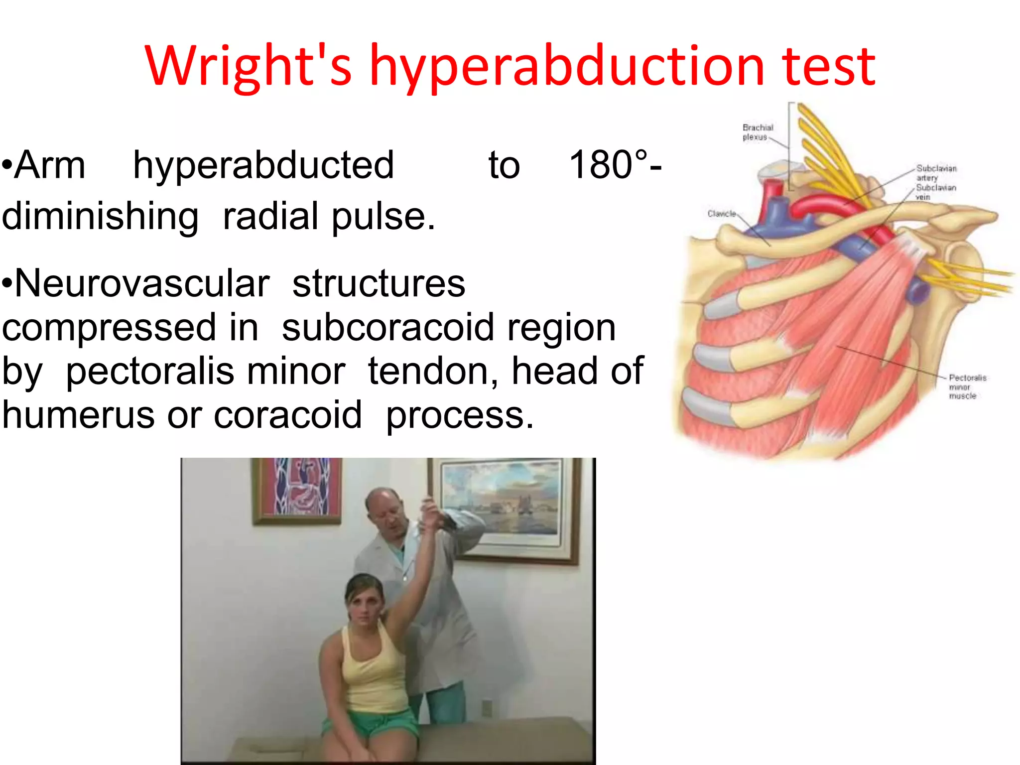 Clinical examination of spine | PPT