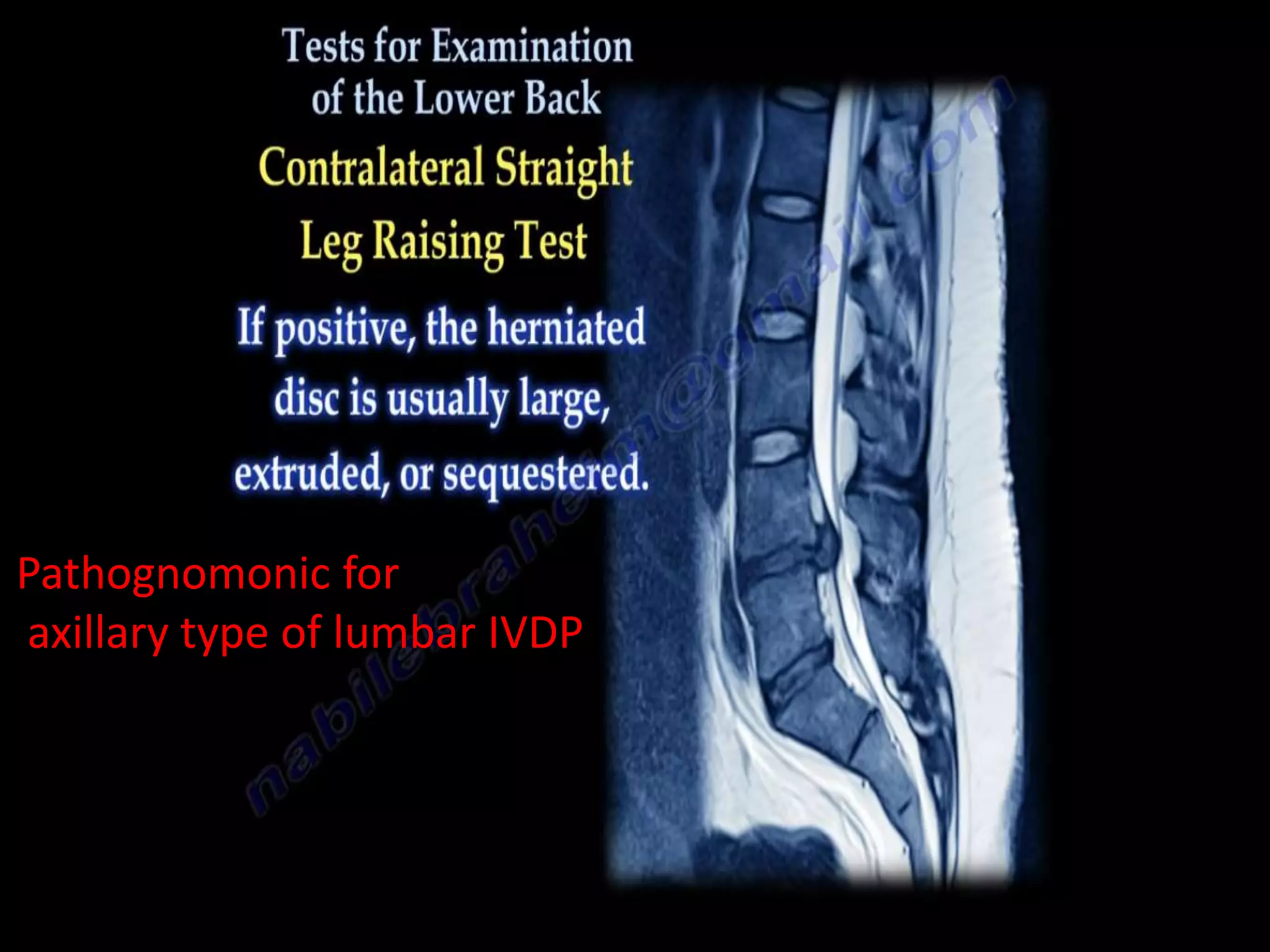 Clinical examination of spine | PPT
