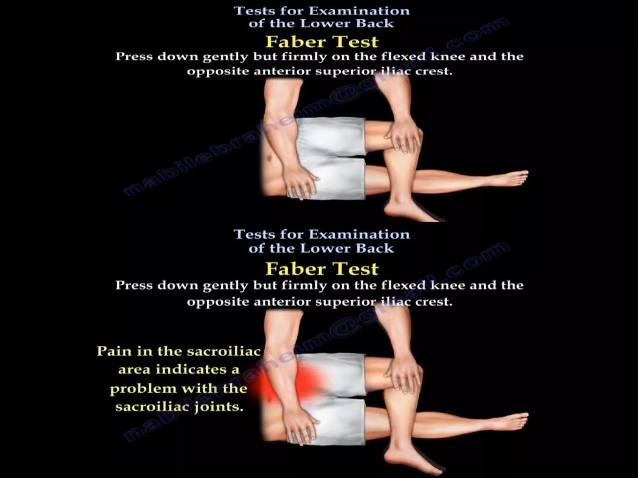 Clinical examination of spine | PPT
