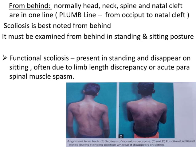 Clinical examination of spine | PPT