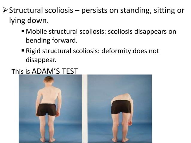 Clinical examination of spine | PPT