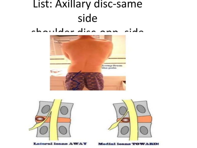 Clinical examination of spine | PPT