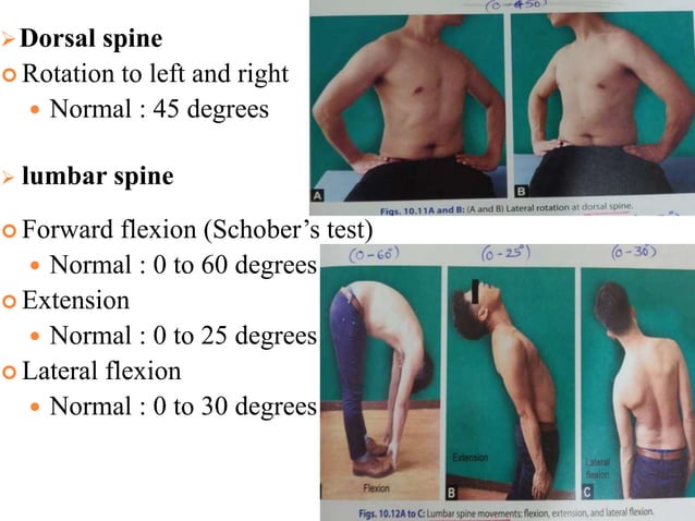 Clinical examination of spine | PPT