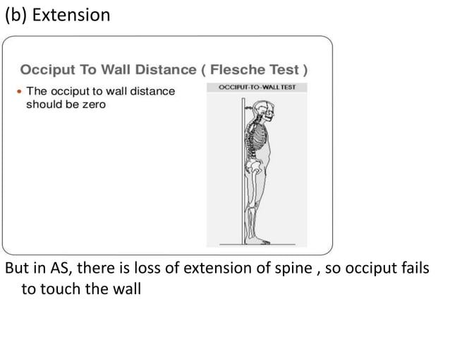 Clinical examination of spine | PPT