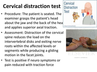 Cervical Distraction Test