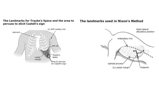 Clinical examination of spleen | PPTX