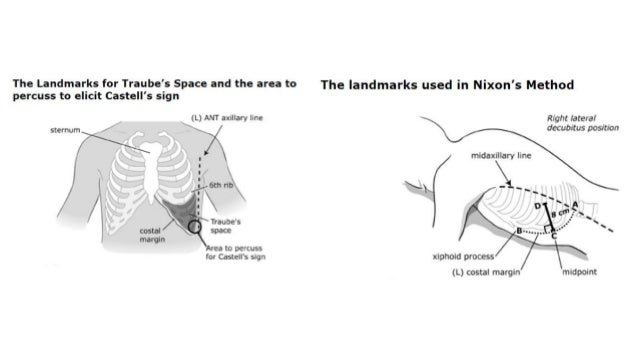 Clinical examination of spleen