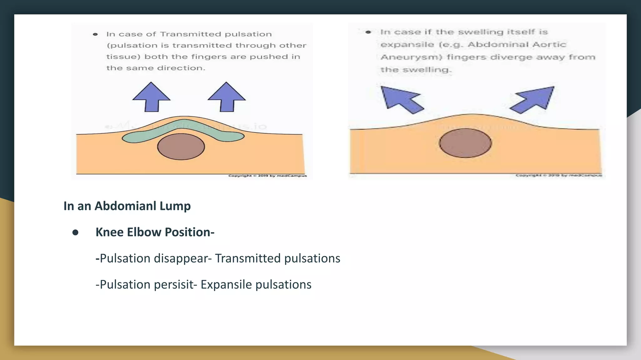 Clinical examination of swelling | PDF