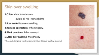 Clinical examination of swelling | PDF