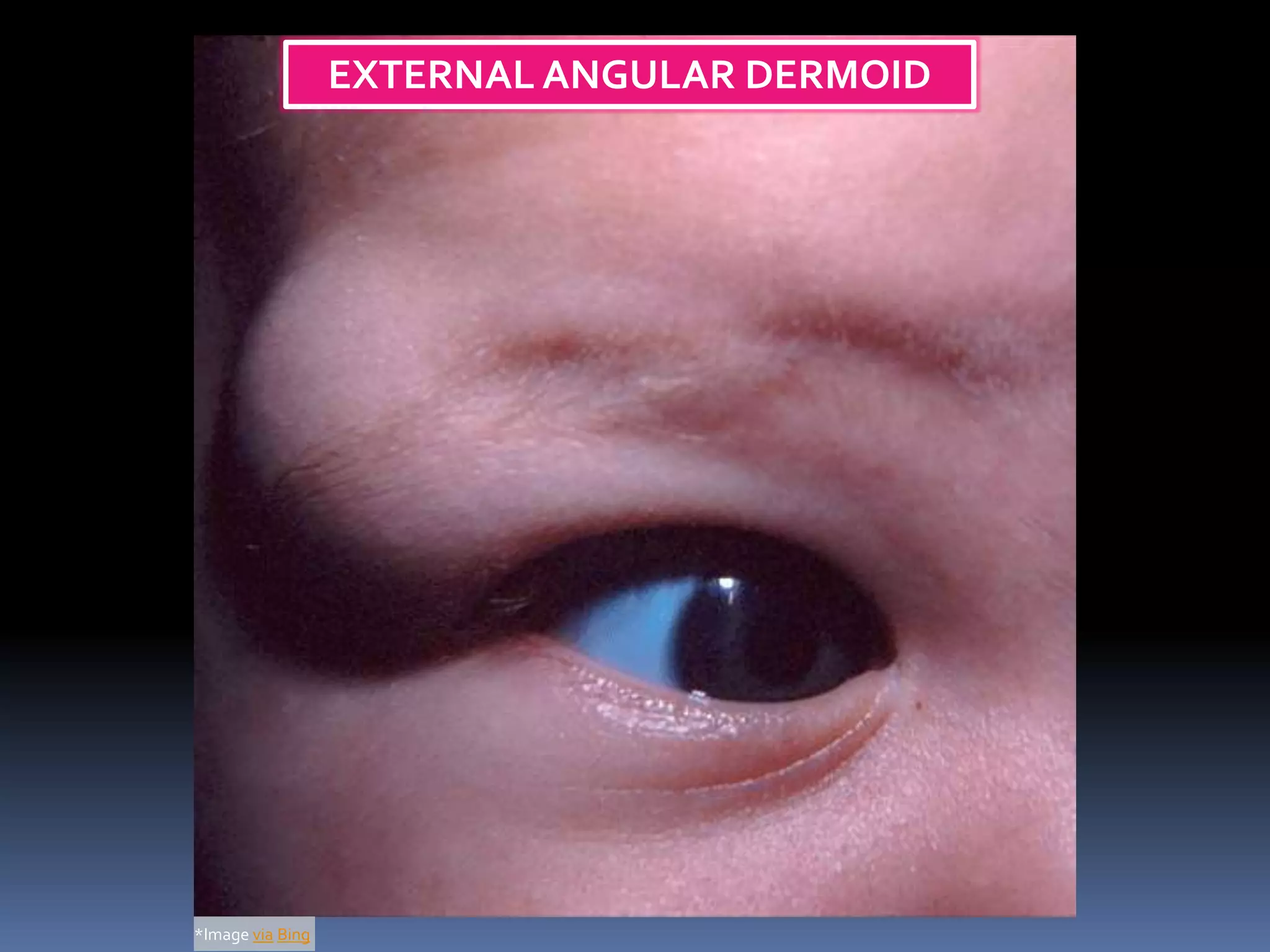 Clinical examination of swelling | PPTX