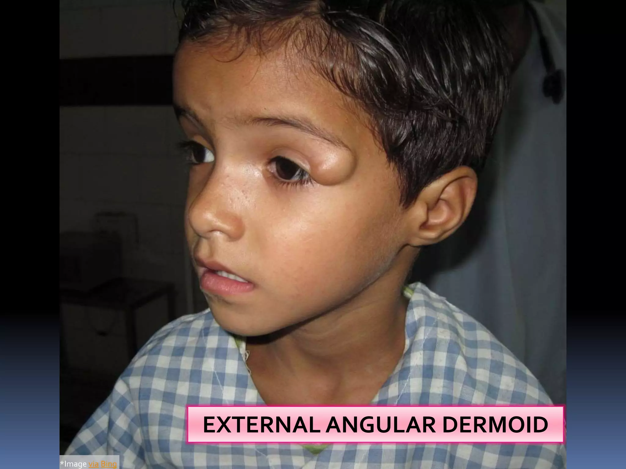 Clinical examination of swelling | PPTX