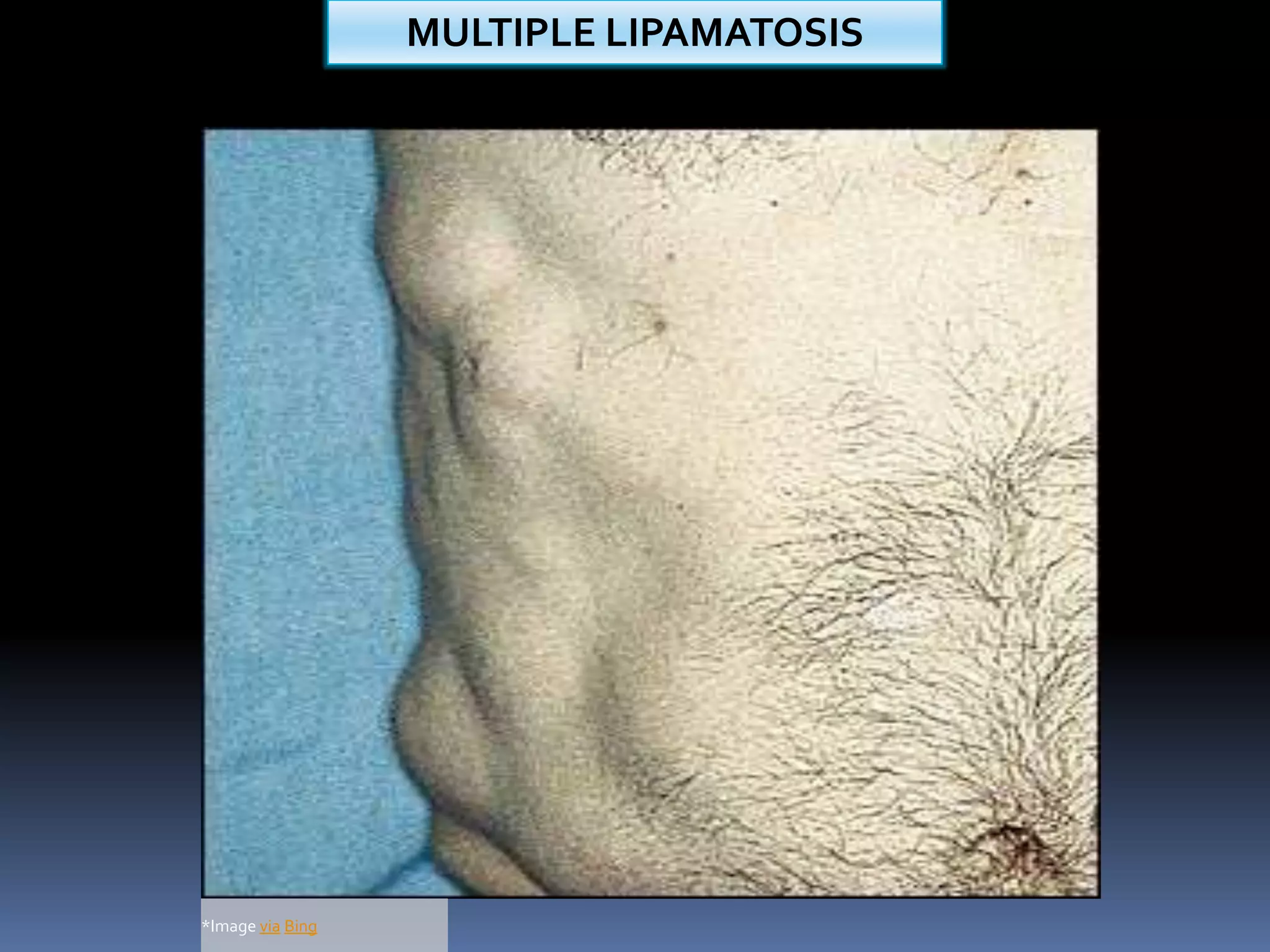 Clinical examination of swelling | PPTX