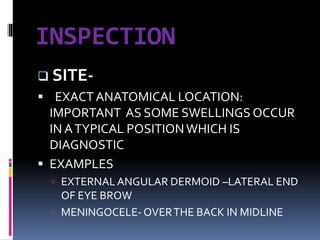 Clinical examination of swelling | PPTX