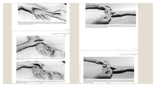 CLINICAL EXAMINATION OF THE HAND & WRIST JOINT. SLIDESHARE.pptx