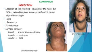 Clinical Examination of The Thyroid.pptx