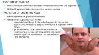Clinical Examination of The Thyroid.pptx