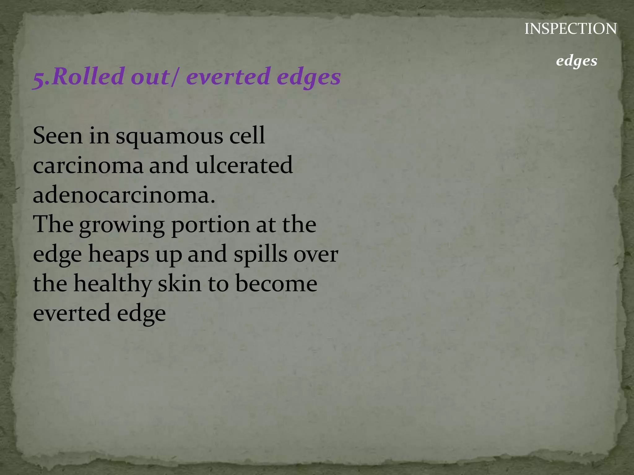 Clinical examination of ulcers | PPTX