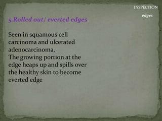 Clinical examination of ulcers | PPTX