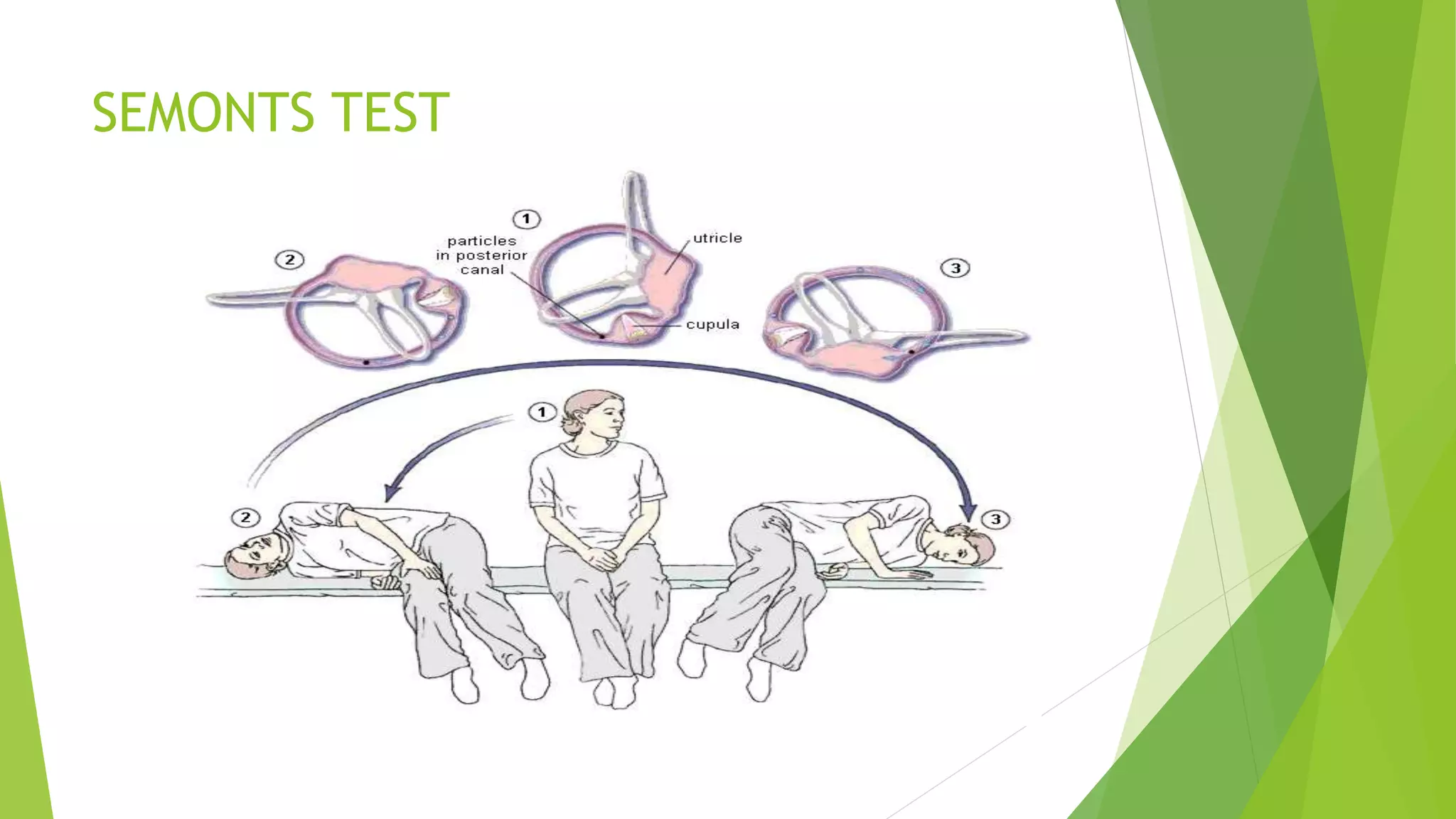 Clinical examination of vertigo | PPTX