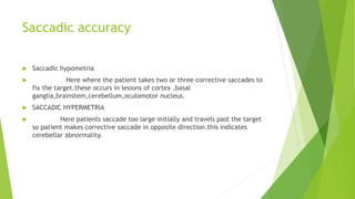 Clinical examination of vertigo | PPTX