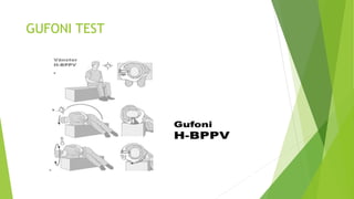 Clinical examination of vertigo | PPTX