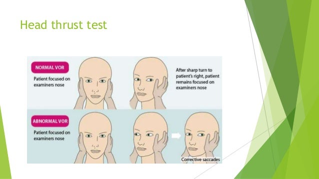 Clinical examination of vertigo