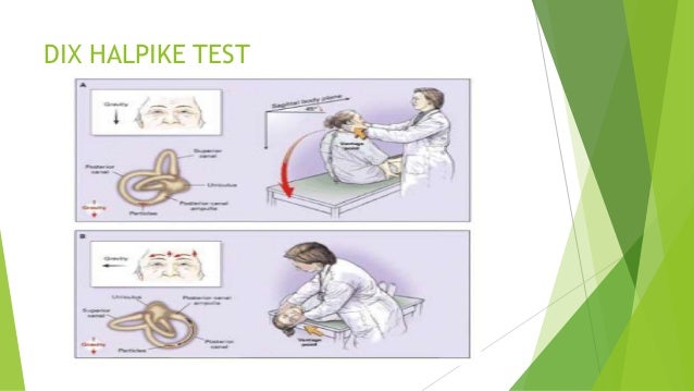 Clinical examination of vertigo